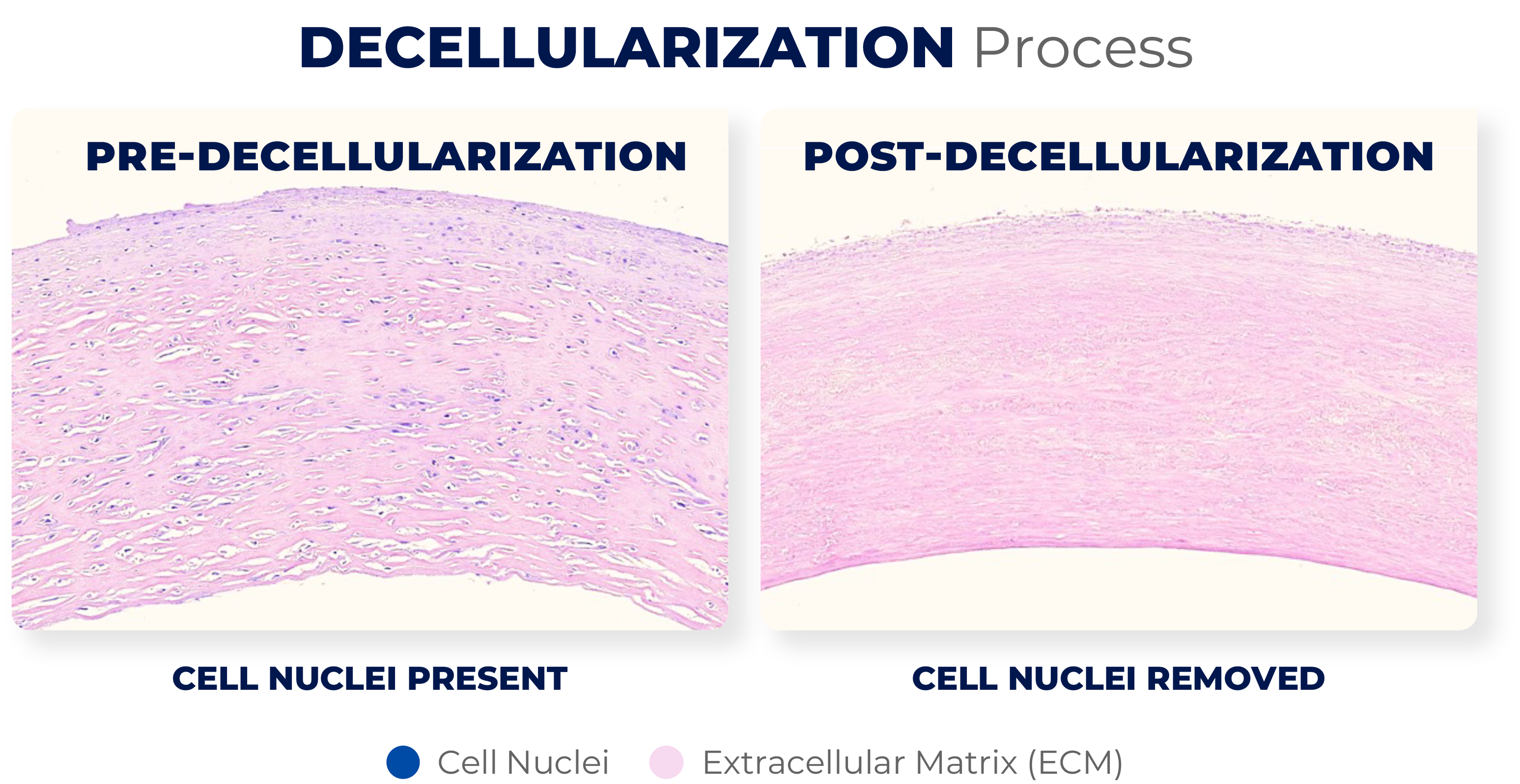 How it Works - Symvess™ acellular tissue engineered vessel-tyod