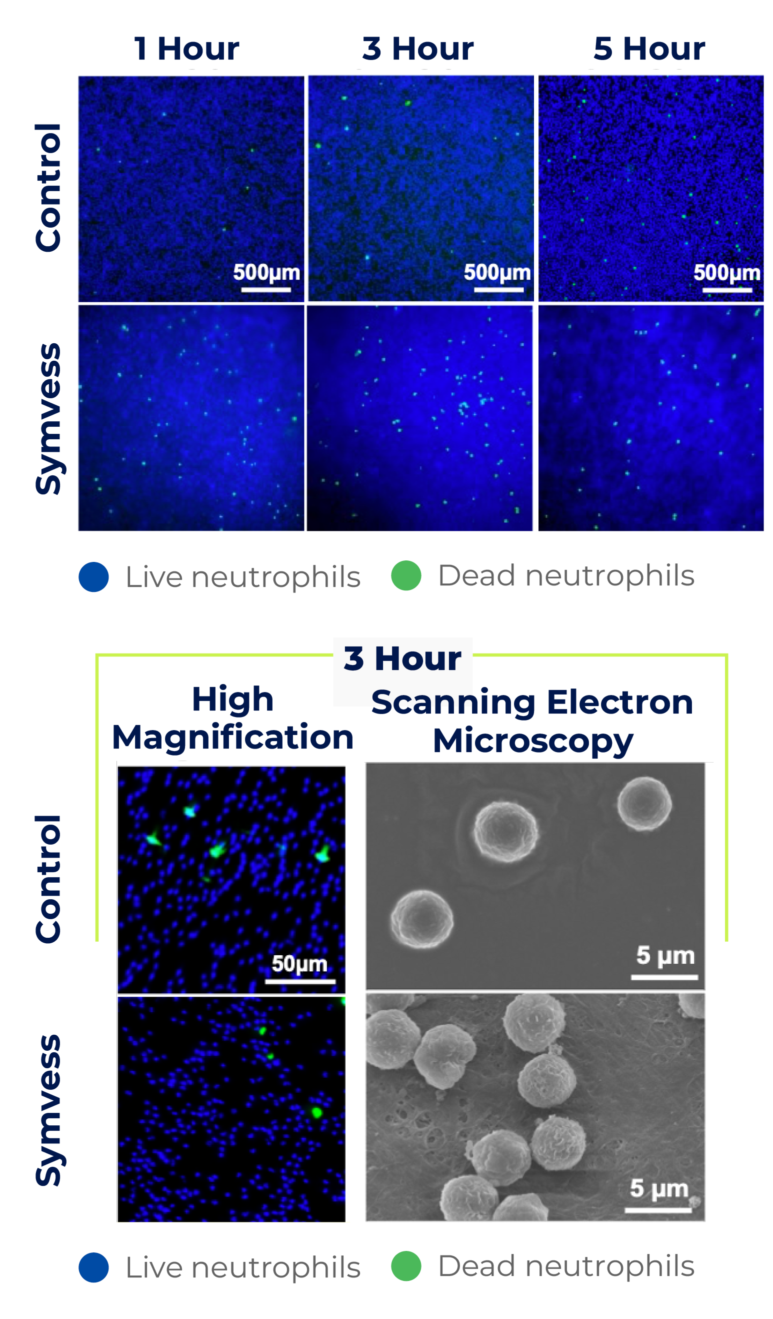 How it Works - Symvess™ acellular tissue engineered vessel-tyod